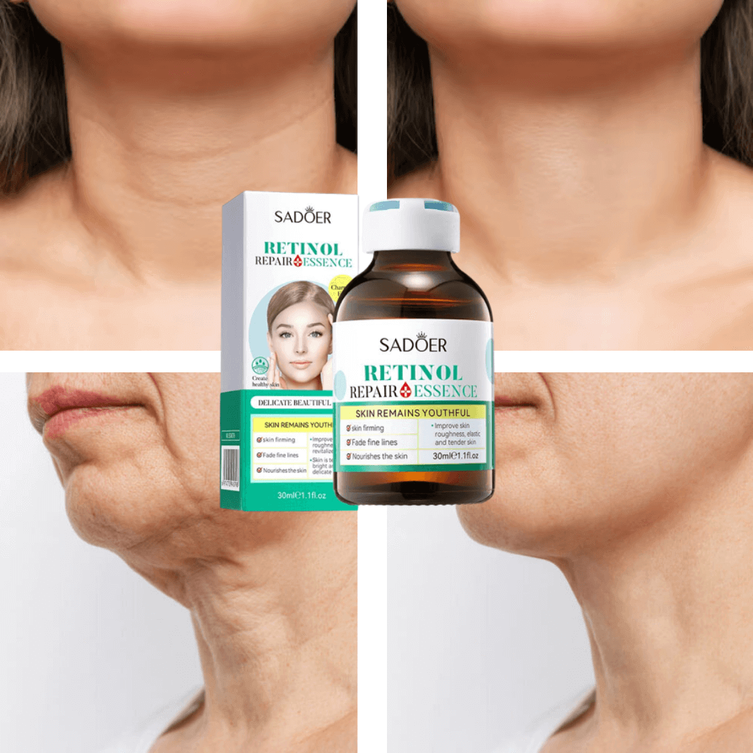 SUERO FACIAL DE RETINOL ELIMINADOR DE ARRUGAS ORIGINAL® – Noah Tienda